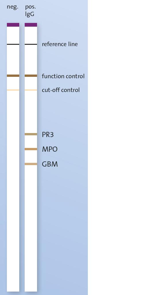 Vasculitis LIA - Medsource Ozone Biomedicals