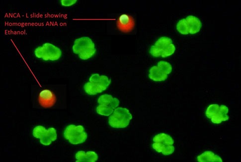ANCA-L Ethanol - Medsource Ozone Biomedicals